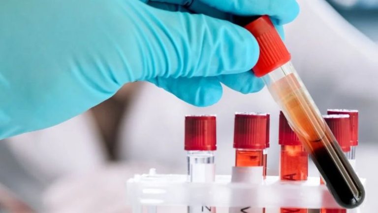 تست انسولین چیست و نحوه تفسیر آن چگونه است؟ | دارو دات کام